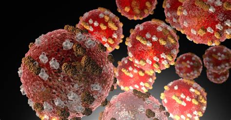 Number Of Measles Cases In Kentucky Rise