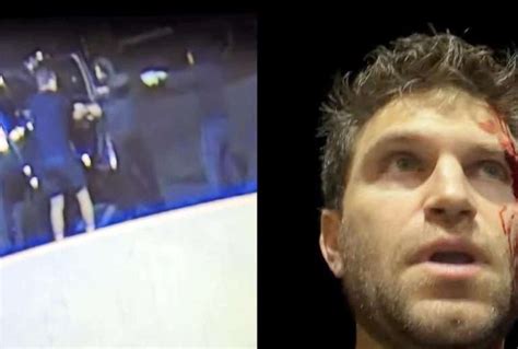 Actor Keegan Allen Struck In The Head And Robbed At Gunpoint In West
