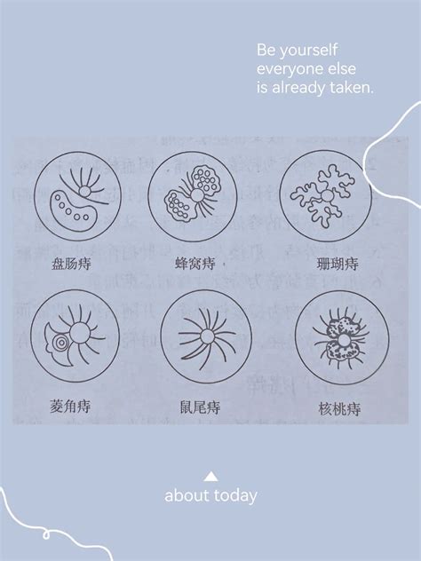 看看古人对痔疮的分型，惊讶了，由清政府编纂的大型医学丛书，《 抖音