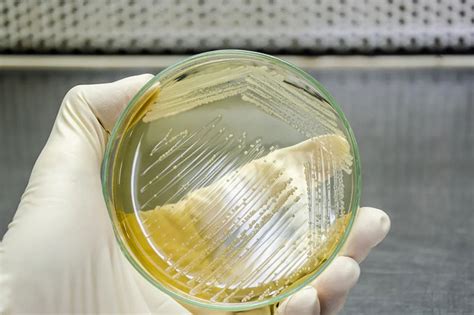 Health Canada Recognises Saccharomyces Cerevisiae As A Source Of