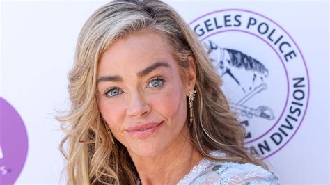 Denise Richards Facelift Sparks Head Transplant Reactions