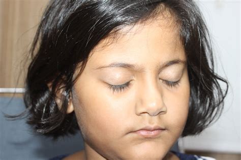 Full Recovery In Case Of Abcd Airborne Contact Dermatitis And