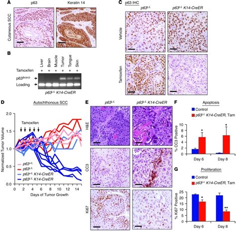 Fgfr2 Signaling Underlies P63 Oncogenic Function In Squamous Cell Carcinoma Abstract Europe Pmc