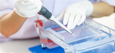 How To Interpret Dna Gel Electrophoresis Results Goldbio