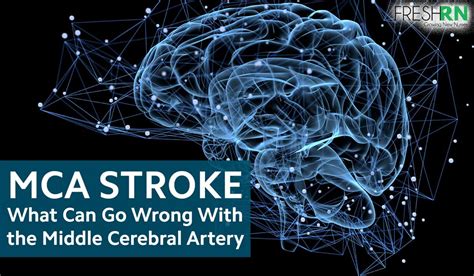 Left Mca Strokes What Happens With Strokes Involving The Left Middle Cerebral Artery Freshrn