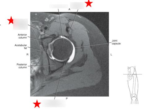 Procedures I Hip Part 9 Ligaments And Labrum Diagram Quizlet