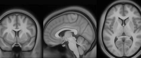 Mapping The Subcortex The Most Ancient Part Of The Brain Freeschi