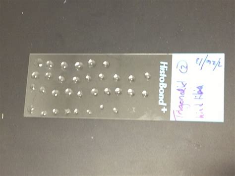 The Steps Of Sectioning