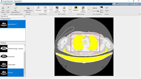 how to convert dicom slices to mat file r matlab