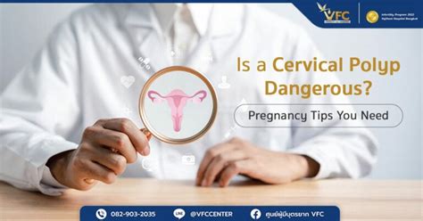 Is A Cervical Polyp Dangerous Pregnancy Tips You Need V