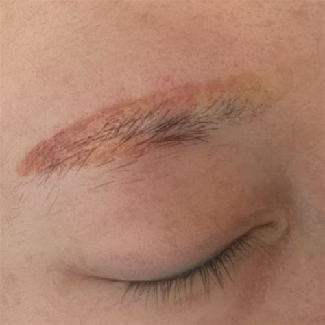 붉은눈썹문신 잔흔 중화 신중하게 하셔야 합니다 우아함뷰티 반영구 수강 네이버 블로그