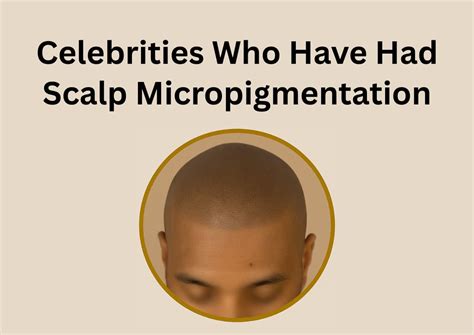 Scalp Micropigmentation Benefits Side Effects And Risks
