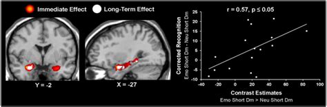 Hemispheric Dissociation Linked The Immediate Vs Long Term Effects Download Scientific