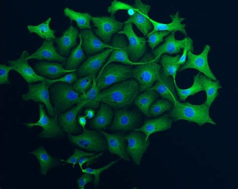 Multi Walled Carbon Nanotube