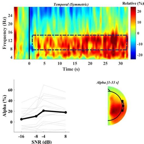 Top Row The Spectrogram Of Ear Eeg Using Symmetrical Referencing