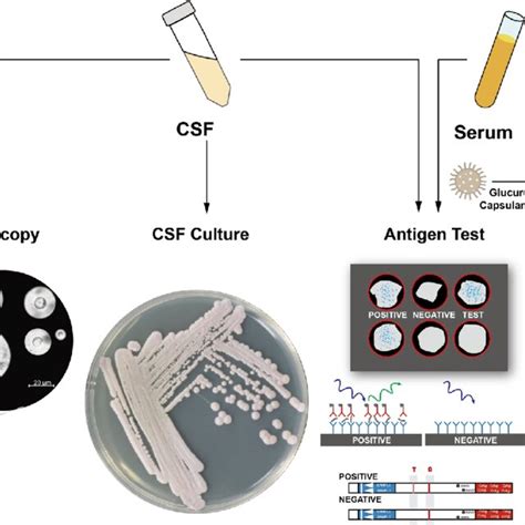 Diagnosis Of Cryptococcal Infections India Ink Microscopy Download Scientific Diagram