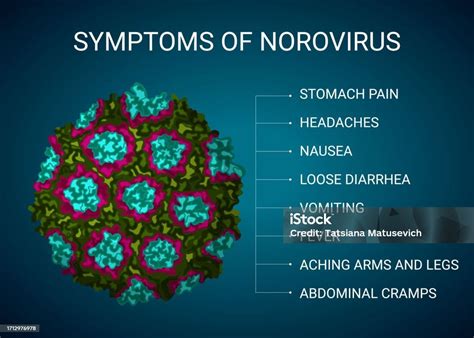 Ilustración De Ilustración De Los Síntomas Del Norovirus Infografía