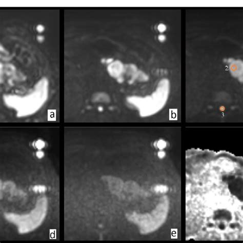 Four Diffusion Types Non Restricted Hindered Restricted With Download Scientific Diagram