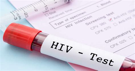 Nhs Hiv Testing Rollout Identifies Hundreds Of New Cases