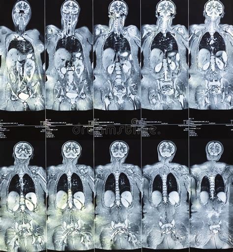 Magnetic Computer Tomography Stock Image Image Of Woman Female