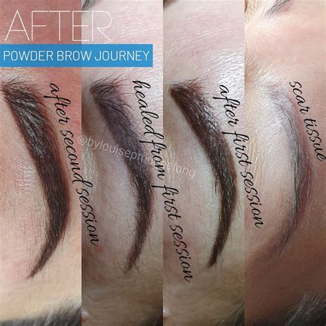 Corrective Work Cosmetic Tattoo By Louise Australia