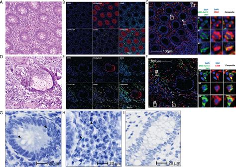 Frontiers Case Report Persistence Of Residual Antigen And Rna Of The Sars Cov 2 Virus In