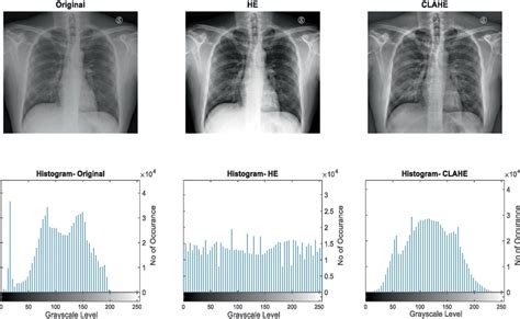 comparison between original he and clahe equalized x ray images with