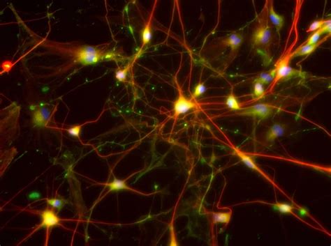 11 Mind Blowing Facts About Cellular Reprogramming