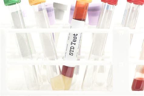 Best Std Tests Of 2019 Updated Nov 2019