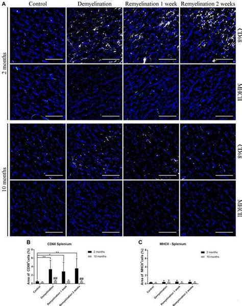 Mhc Class Ii I Ai E Antibody 14 5321 82