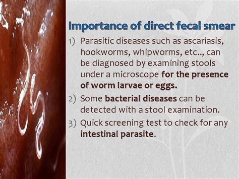 Preparation Microscopic Examination Of A Direct Fecal Smear