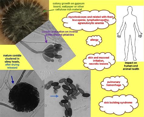 Update On Stachybotrys Chartarum—black Mold Perceived As Toxigenic And