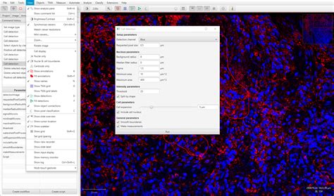 Cell Detection Is Not Working Displayed Image Analysis Image Sc Forum
