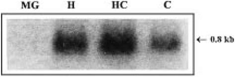 Rna Blot Hybridization Analysis Of Total Rna From Tomato Fruit