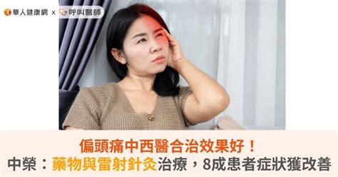 偏頭痛中西醫合治效果好！中榮：藥物與雷射針灸治療，8成患者症狀獲得改善 蕃新聞