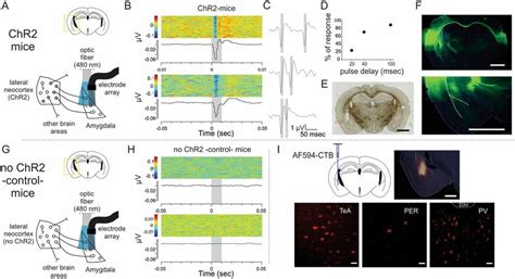 Monosynaptic Connection Between The Lateral Neocortex And The Amygdala
