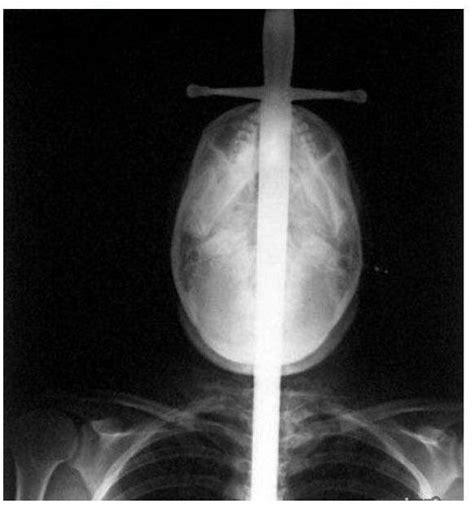 칼을 목구멍으로 삼키는 마술의 비밀