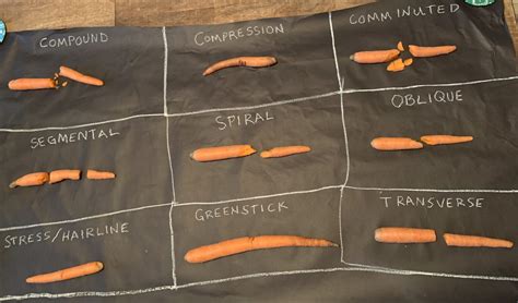Carrot Modeling Of Bone Fractures Human Steam