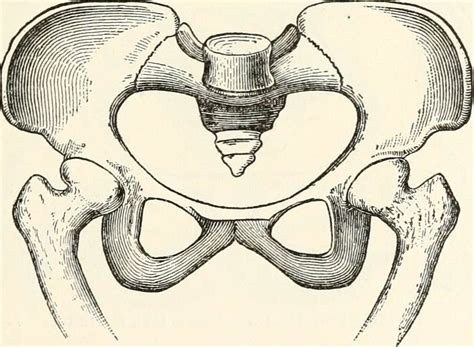 Rachitic Pelvis