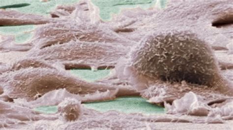 Sarcoma Cancer Cell Culture Sem Stock Video Clip K001 5830 Science Photo Library