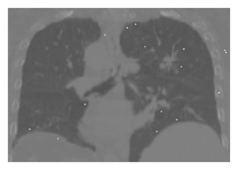 Feature Point Detection A Sift B Proposed Method The White Dots