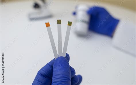 Bacterial Vaginosis Vaginal Ph Diagnostic Scale By Which You Can Measure Whether Acidity