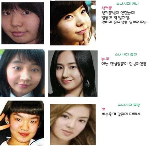 Girls Generation Before Plastic Surgery Pictures And Wallpaper