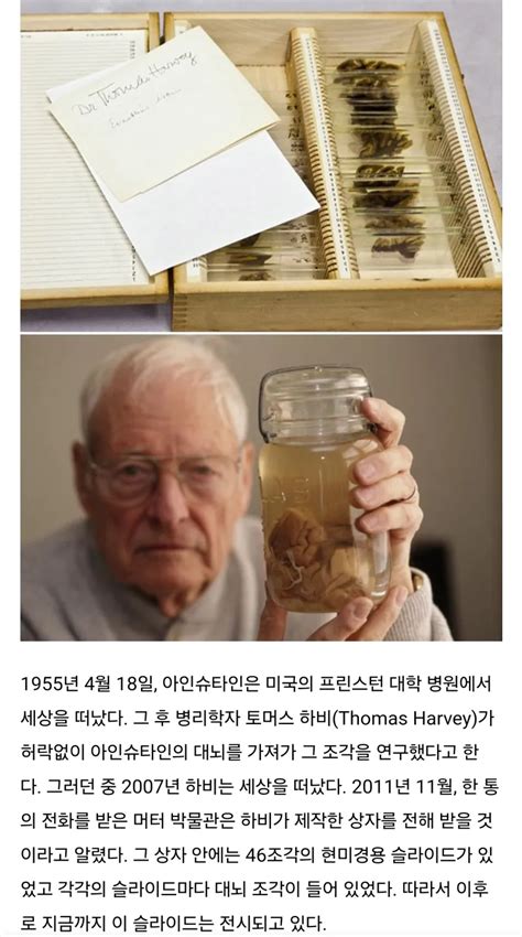 미국 박물관에 전시된 아인슈타인의 뇌 인스티즈 Instiz 이슈 카테고리