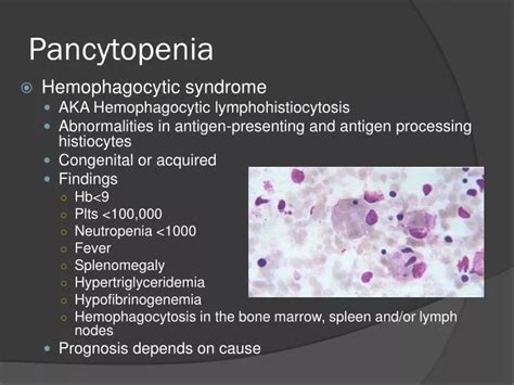 Ppt Pancytopenia Powerpoint Presentation Free Download Id3095634