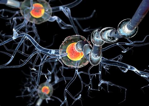 MS Treatment Centers To Be Set Up Nationwide Tehran Times