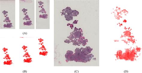Visualization Of Self‐attention Weights A Wsi Thumbnail B Color