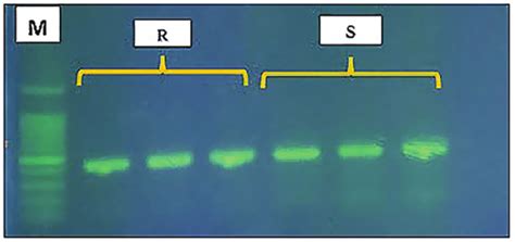 Amplification Of The 440 Bp Fragment Of Vgsc Gene In The 4 Ddt Download Scientific Diagram