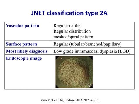 Jnet Classification Of Colo Rectal Polyps Pptx Medical Health