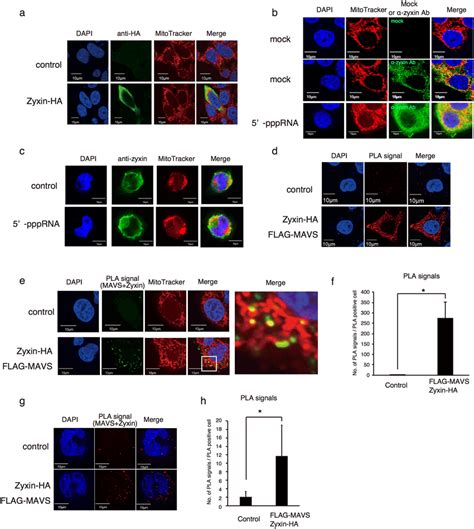 Subcellular Localization Of Zyxin A Empty Vector Or Zyxin Ha Download Scientific Diagram